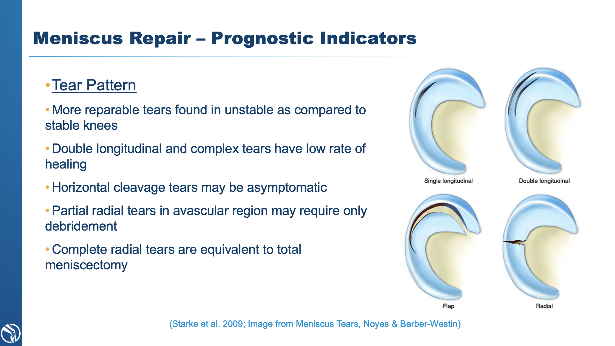 3 Types Of Meniscus Tear Treatment Knee Specialist Baton Rouge LA 3 Types Of Meniscus Tear Treatment Knee Specialist Baton Rouge LA